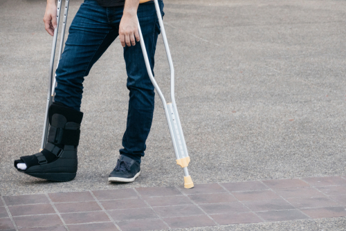 Buying Guide: How to Choose the Best Walking Cast Boot