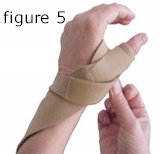 Pediatric Thumb Splint by McKie Splints - FREE Shipping