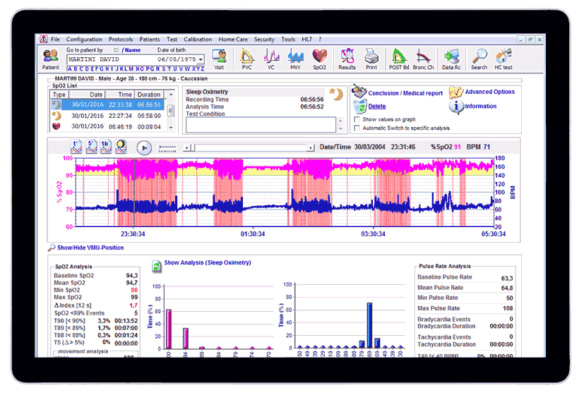 Spirolab Touchscreen Desktop Spirometer with Oximetry