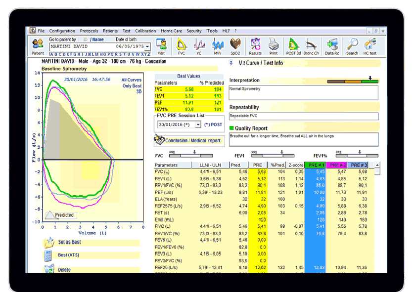 Spirolab Touchscreen Desktop Spirometer with Oximetry