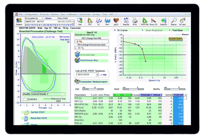 Spirolab Touchscreen Desktop Spirometer with Oximetry