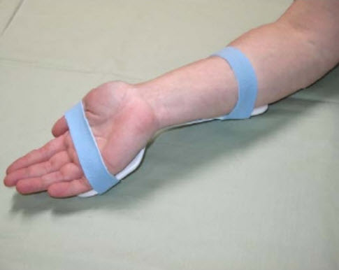 mBrace Surgical Wrist Positioner