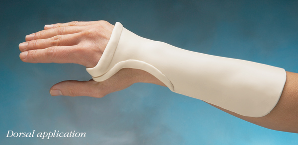 Radial Bar Wrist Cock-Up Splints