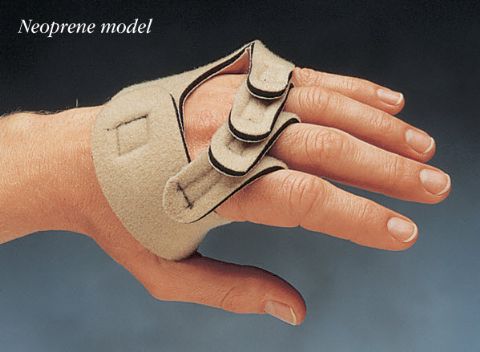 Hand Contracture | Hand Splints | Discounts | Orthosis | Ulnar ...