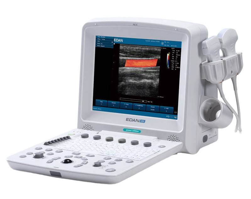 U50 PE General Imaging Color Doppler Ultrasound System for Multi ...