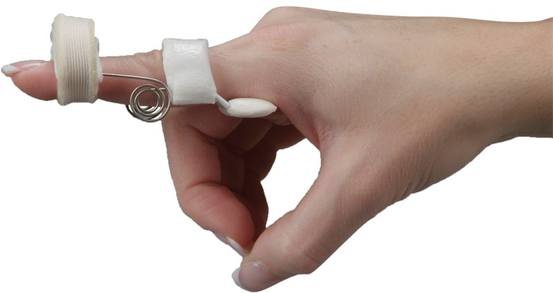 LMB Spring Coil Finger Extension Assist Splint