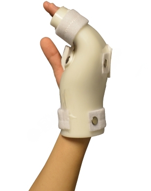 Boxer Splint for Fractures by Bird & Cronin
