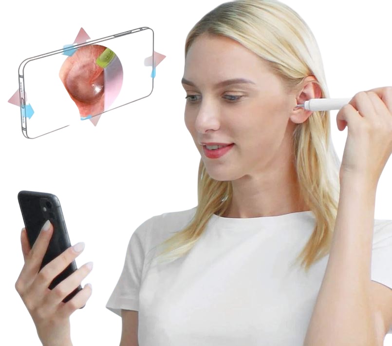 Otoscope Ear Cleaner with Camera and WiFi Connection by ScopeAround