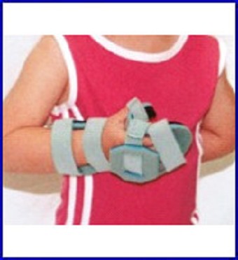 Wrist Orthosis | Hand Splint | Hand Orthosis | Custom Orthotics | Orthosis