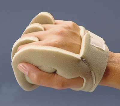 Hand Contracture | Hand Splints | Discounts | Orthosis | Ulnar ...