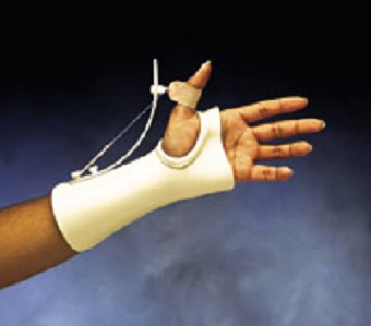 Splinting Kits And Accessories | Orthopedic Supplies | Outriggers ...