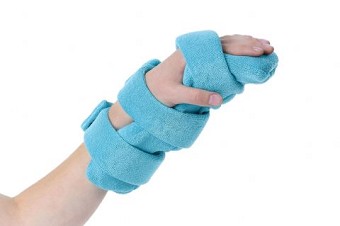 Pediatric Orthotics | Hand Splints | Pediatric Braces | Air Splint ...