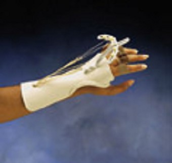 Splinting Kits And Accessories | Orthopedic Supplies | Outriggers ...
