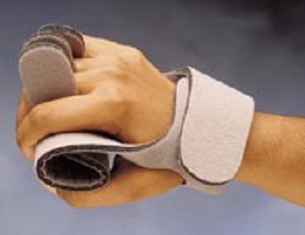Hand Contracture | Hand Splints | Discounts | Orthosis | Ulnar ...