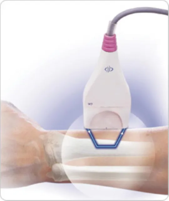 BeamMed Sunlight MiniOmni Portable Bone Density Ultrasonometer