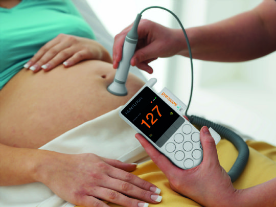 Huntleigh Fetal Doppler - Sonicaid Digital SR2/SR3