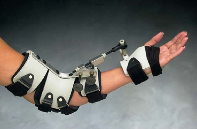 Progress Plus Pronation/Supination Turnbuckle Orthosis