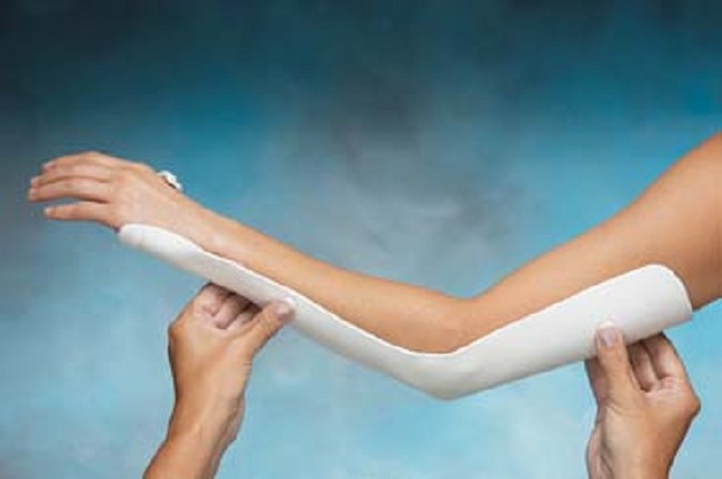 Long Arm Precut Splinting BUY NOW