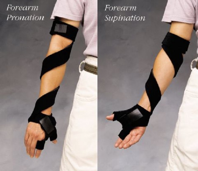 Comfort Cool Spiral Arm Splint