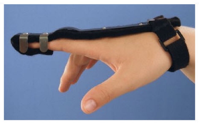 Bunnell Finger Extension Splint