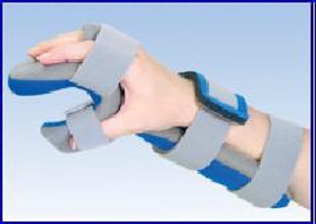 Adaptable Resting Hand Orthosis With Finger Separators