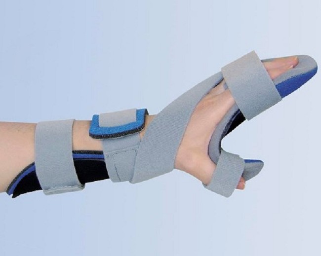 Finger Extension Orthosis