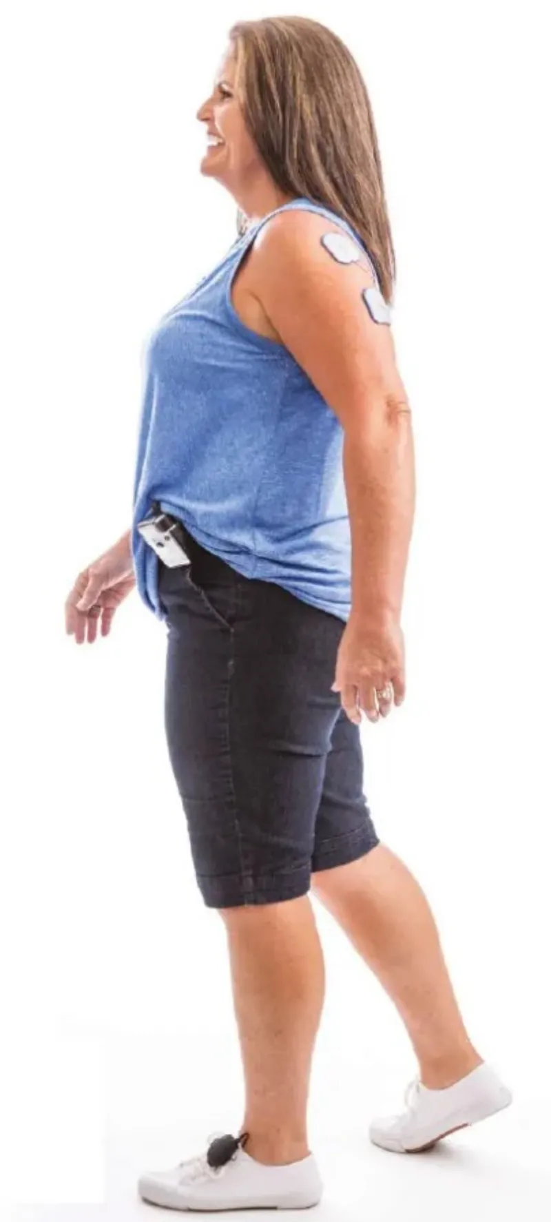 Functional Electrical Stimulation and Neuromuscular Electrical ...