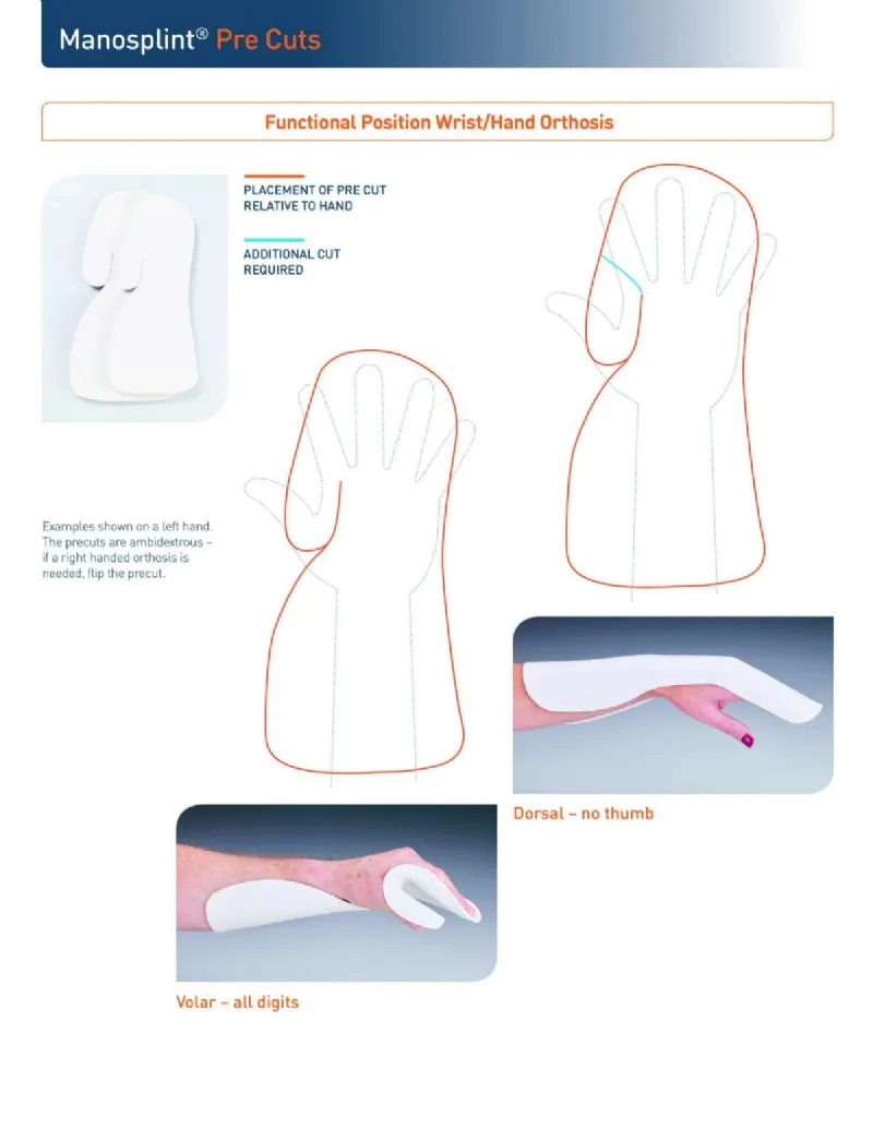 Orthosis for Hand/Wrist Immobilization For Injury and Pain Recovery ...