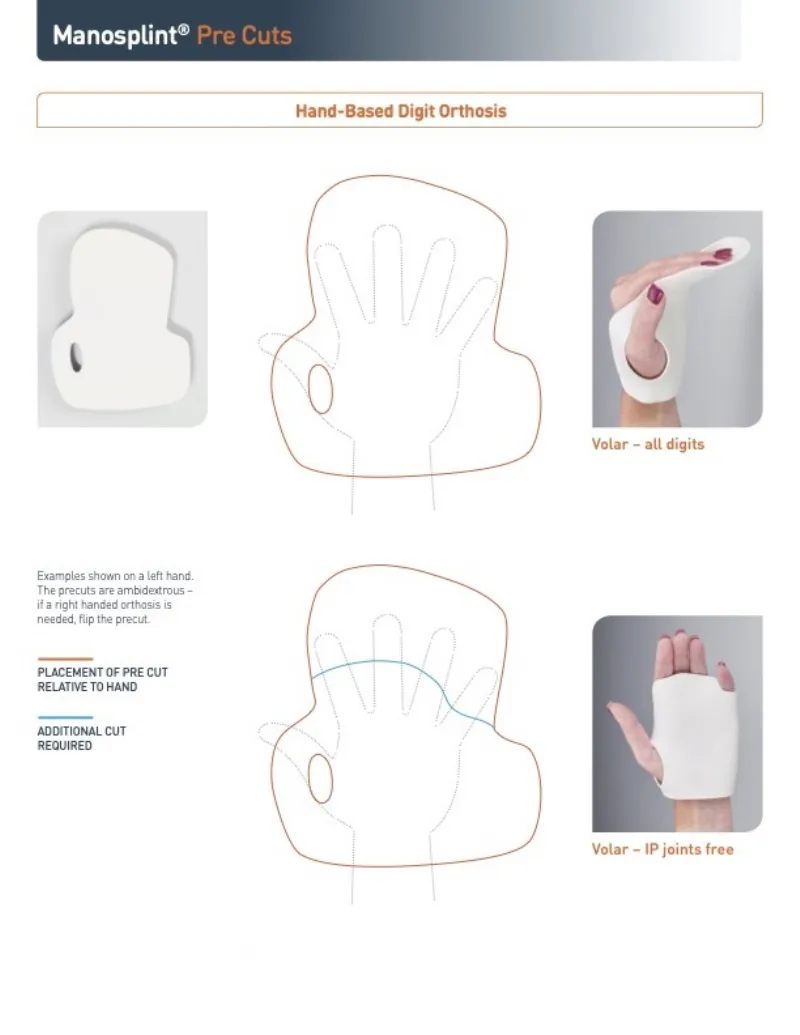 Hand Based Digit Orthosis for Immobilization and Stabilization During ...