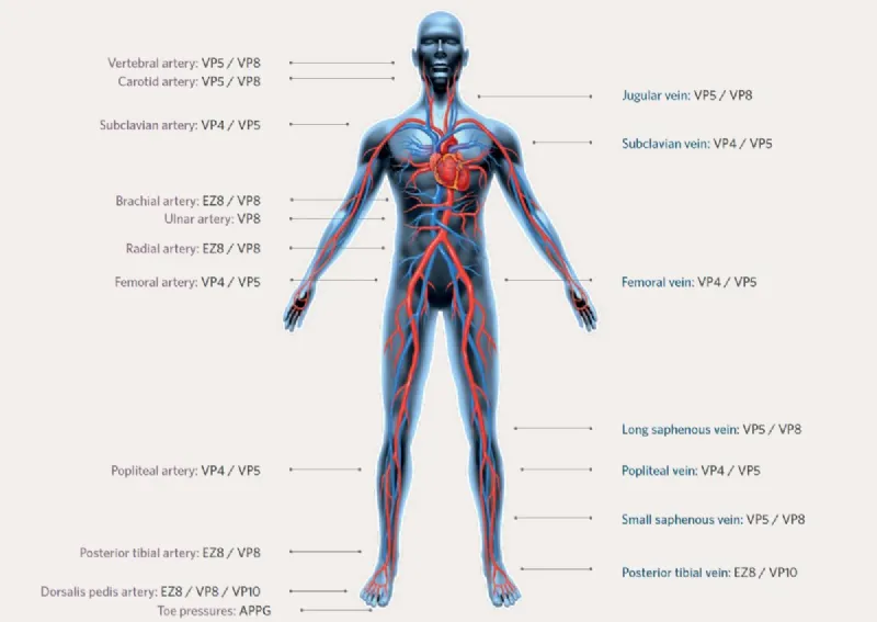 Dopplex SD2 Handheld Vascular Doppler System by Huntleigh