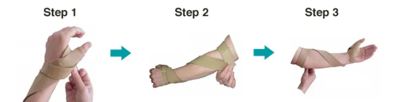 Thumb Splint Sizing Kits from McKie Splints