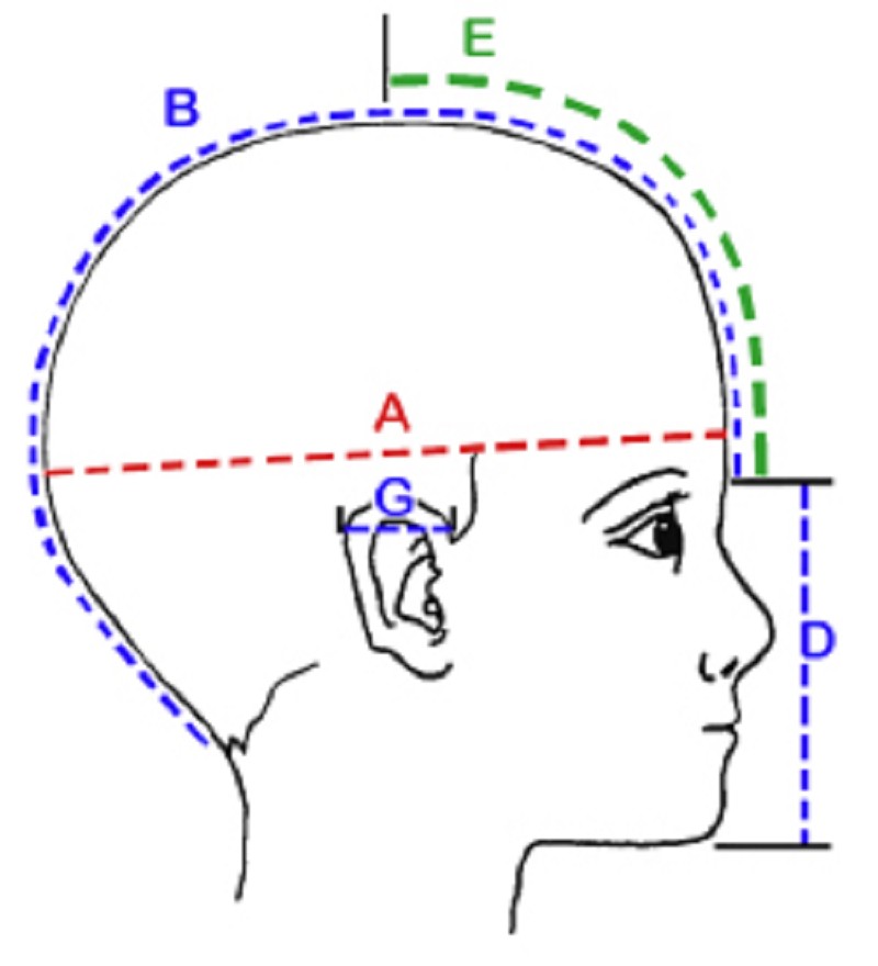 Danmar Hard Shell Helmet with Face Guard