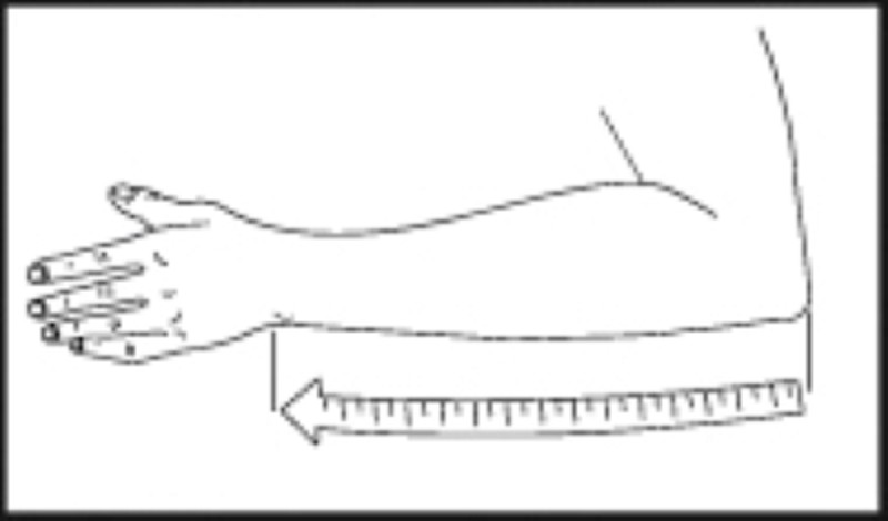 Arm Sling with Abduction Pillow