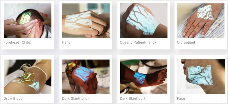 VeinSight VS500 Near-Infrared Vein Finder