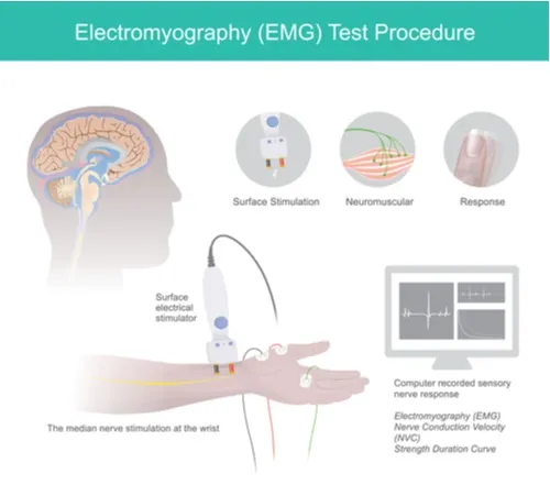 Buyer's Guide to EMG Systems for Physical Therapy & Rehab